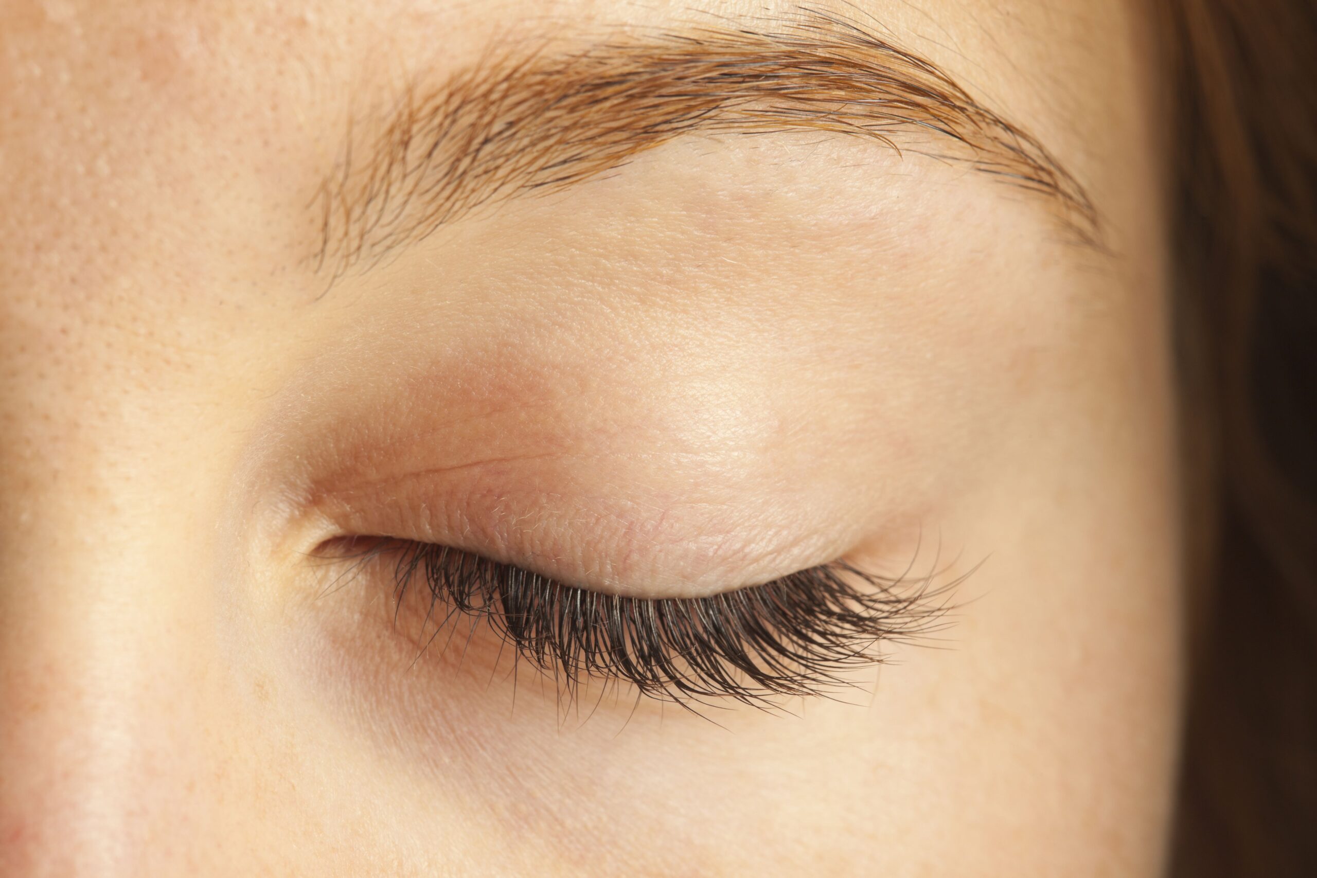 Blepharoplasty procedure in Glasgow Vs in Turkey - blog medespoir